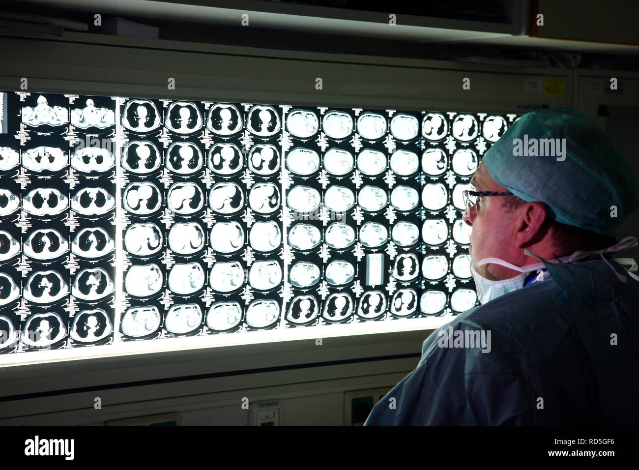 Doctor examining CT scans after a computer tomography, CT, cat-scan ...