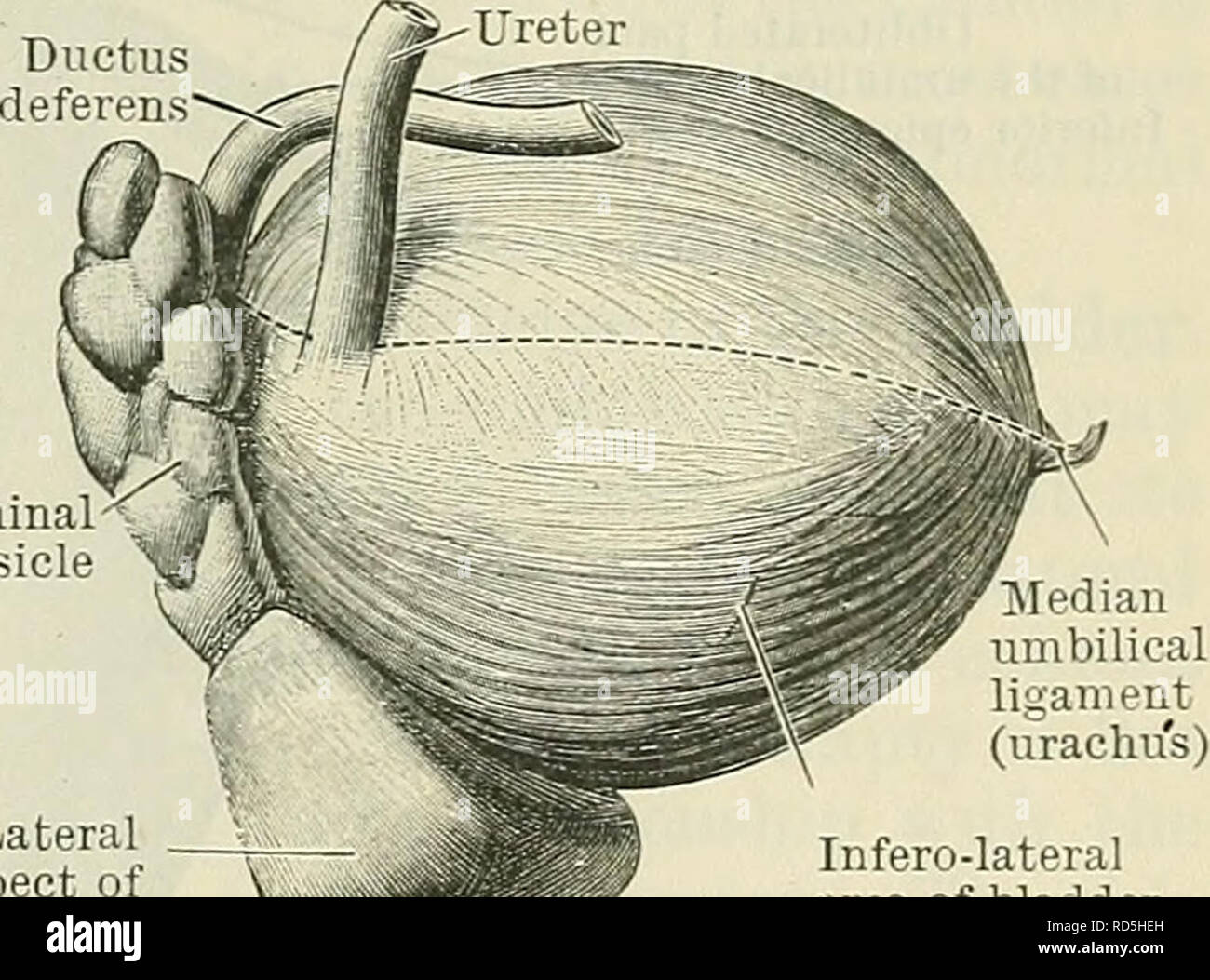 Peritoneum Lateral