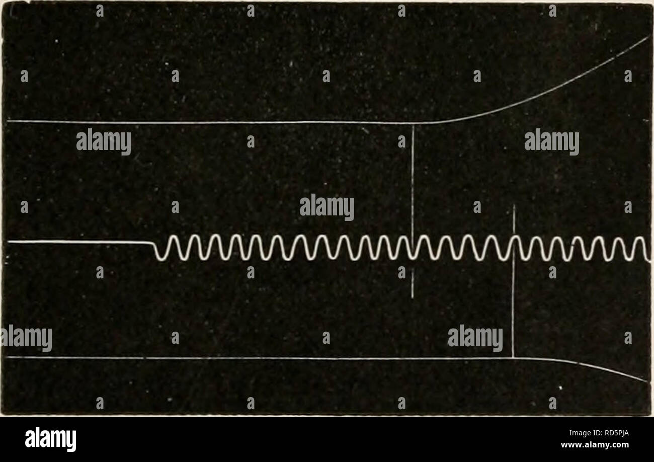 Myograph hi-res stock photography and images - Alamy