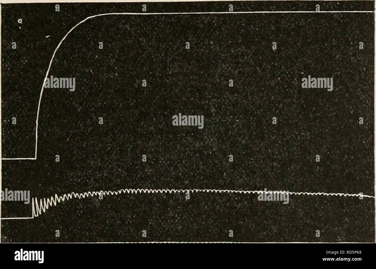 Complete tetanus muscle contraction hi-res stock photography and images ...