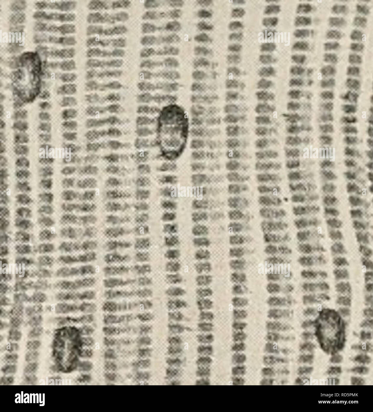 Transverse muscle fibre hi-res stock photography and images - Alamy