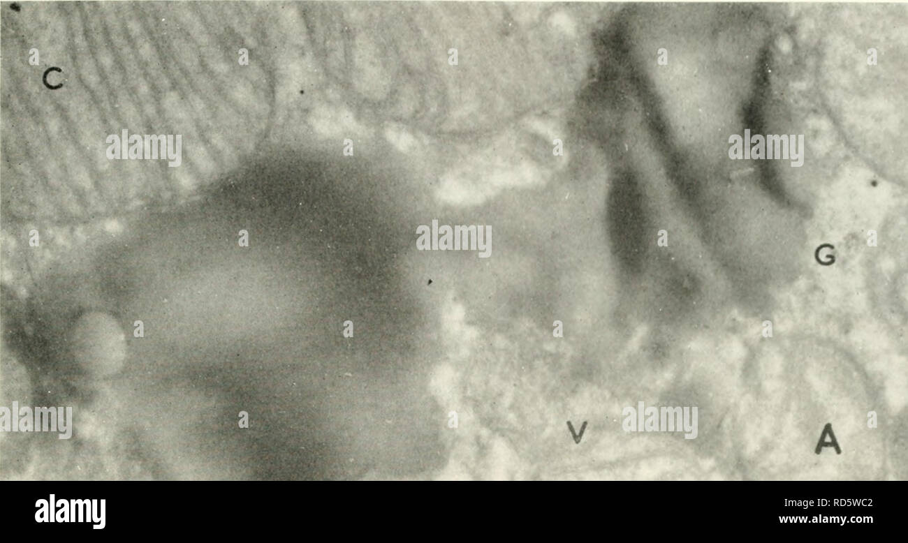 Brown adipose tissue hi-res stock photography and images - Alamy