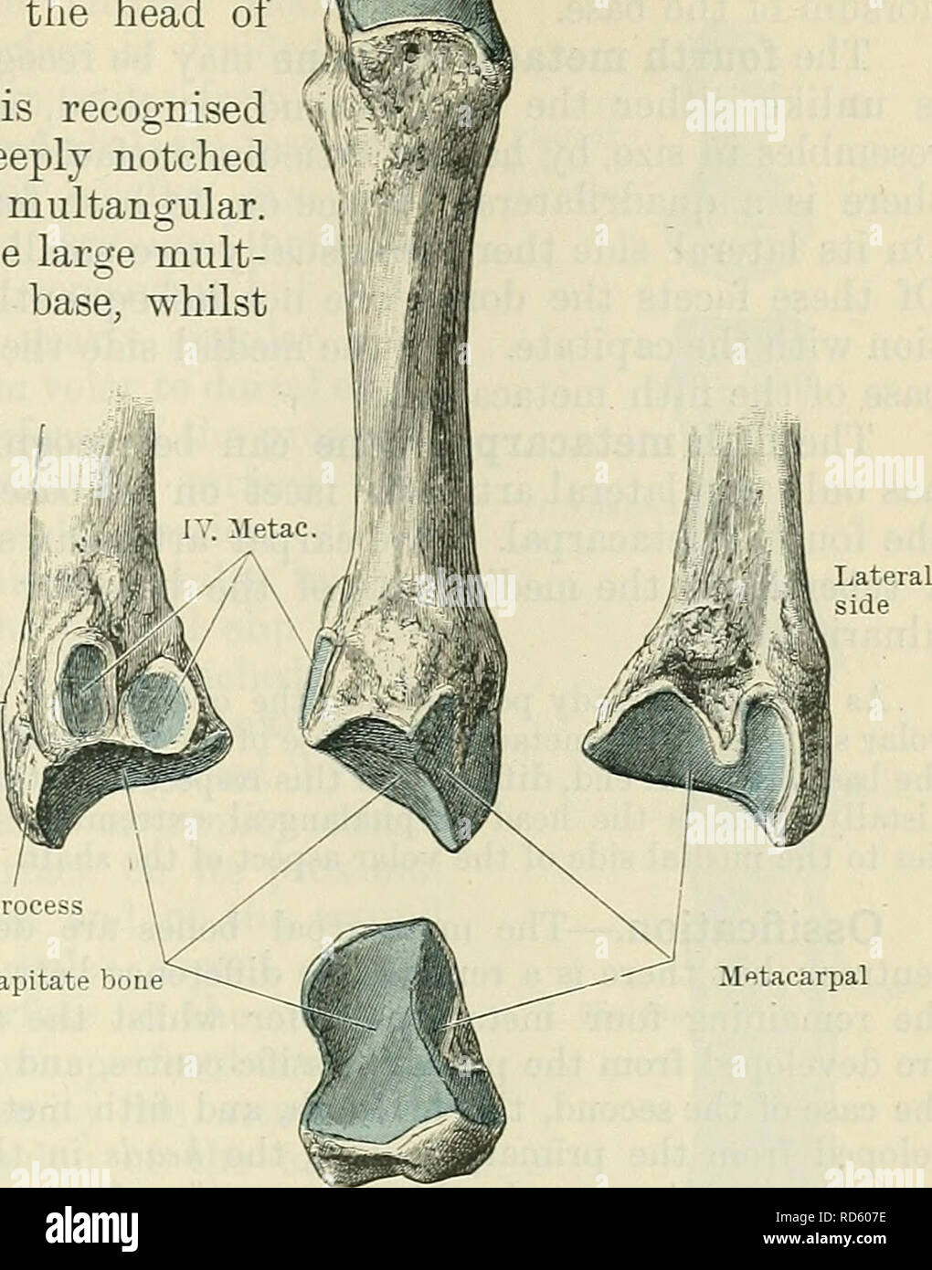 Metacarpal Head Anatomy