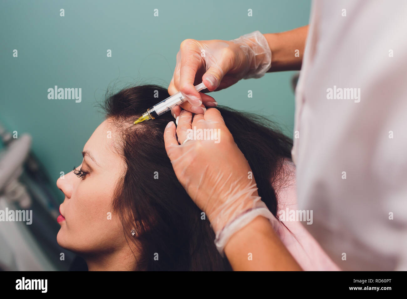 Platelet rich plasma injection procedure. Hair growth stimulation. PRP ...