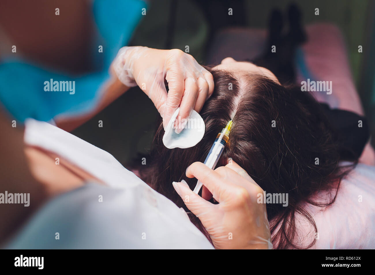 Platelet rich plasma injection procedure. Hair growth stimulation. PRP ...