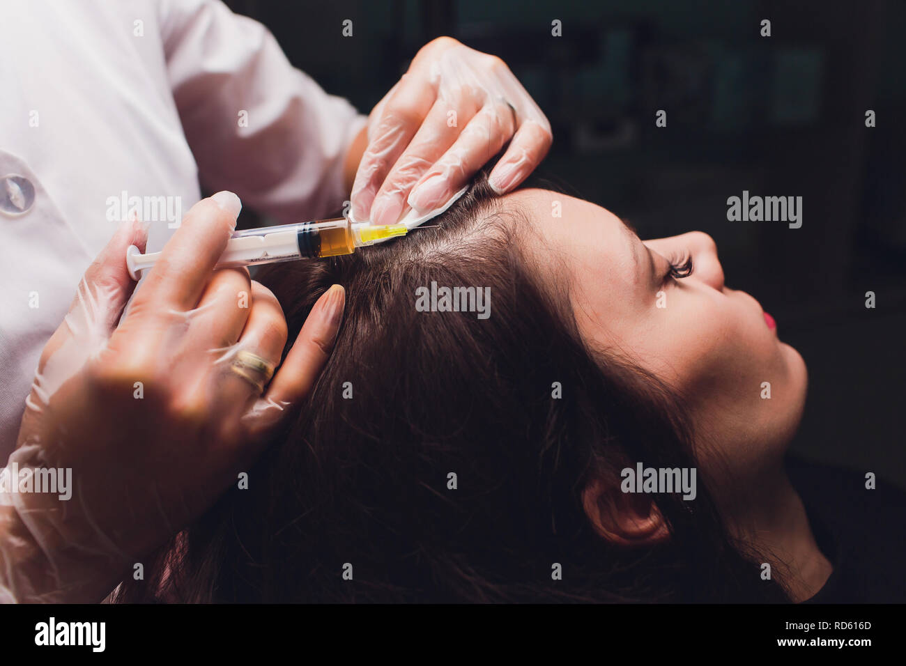 Beautiful woman getting injection for hair growth Stock Photo - Alamy
