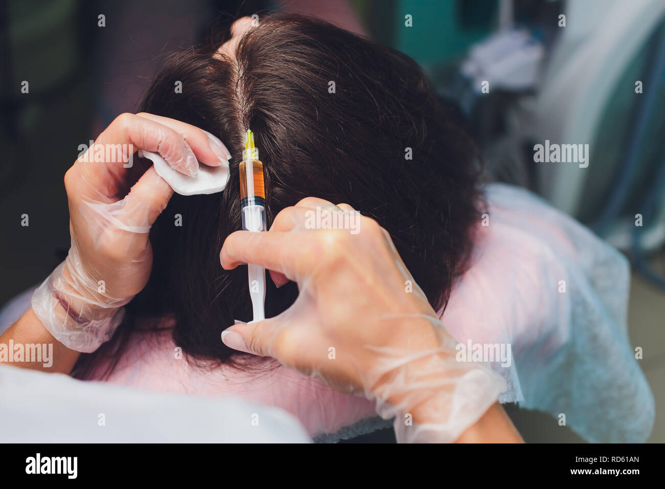 Platelet rich plasma injection procedure. Hair growth stimulation. PRP ...