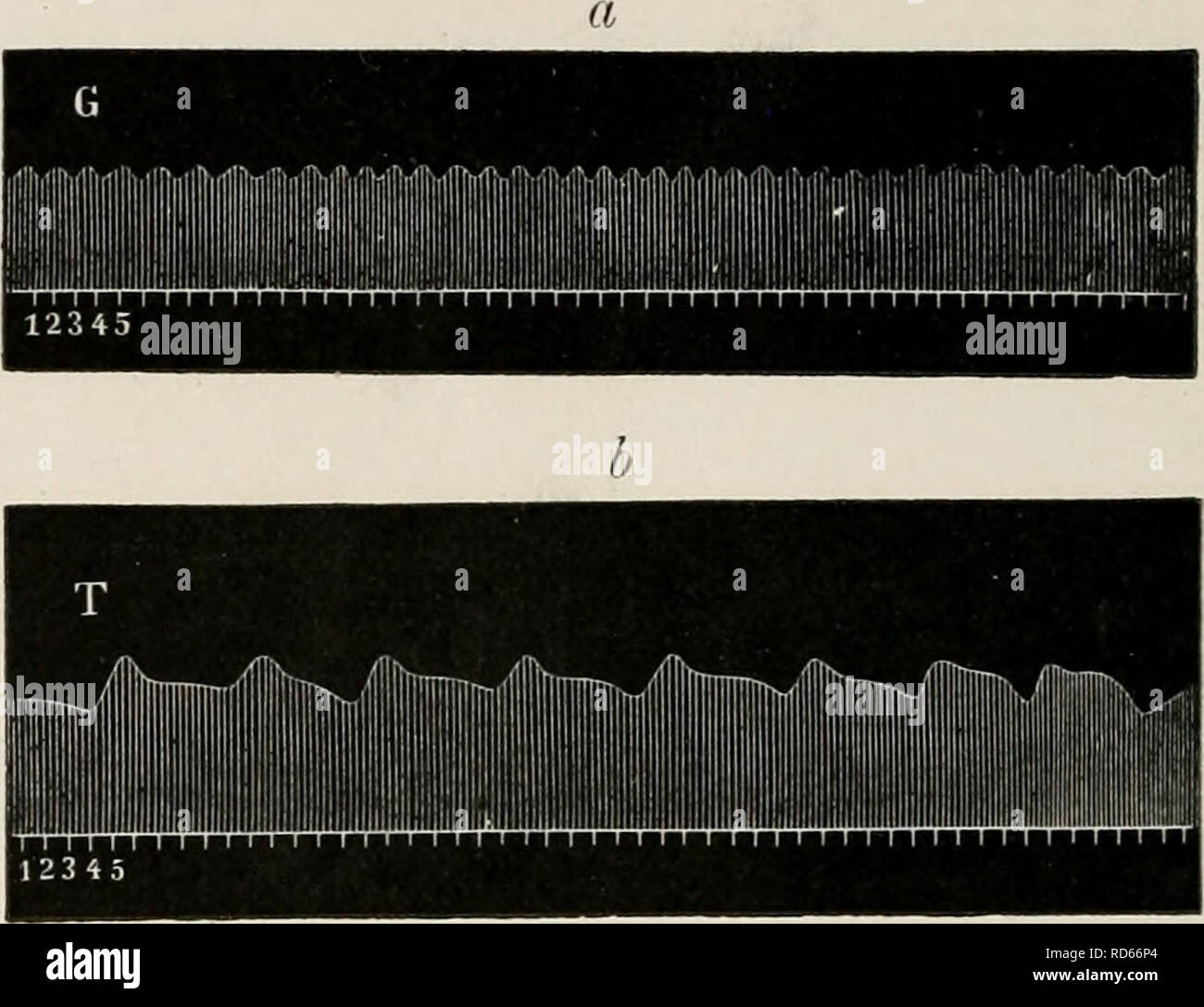 Capillary Electrometer High Resolution Stock Photography and Images - Alamy