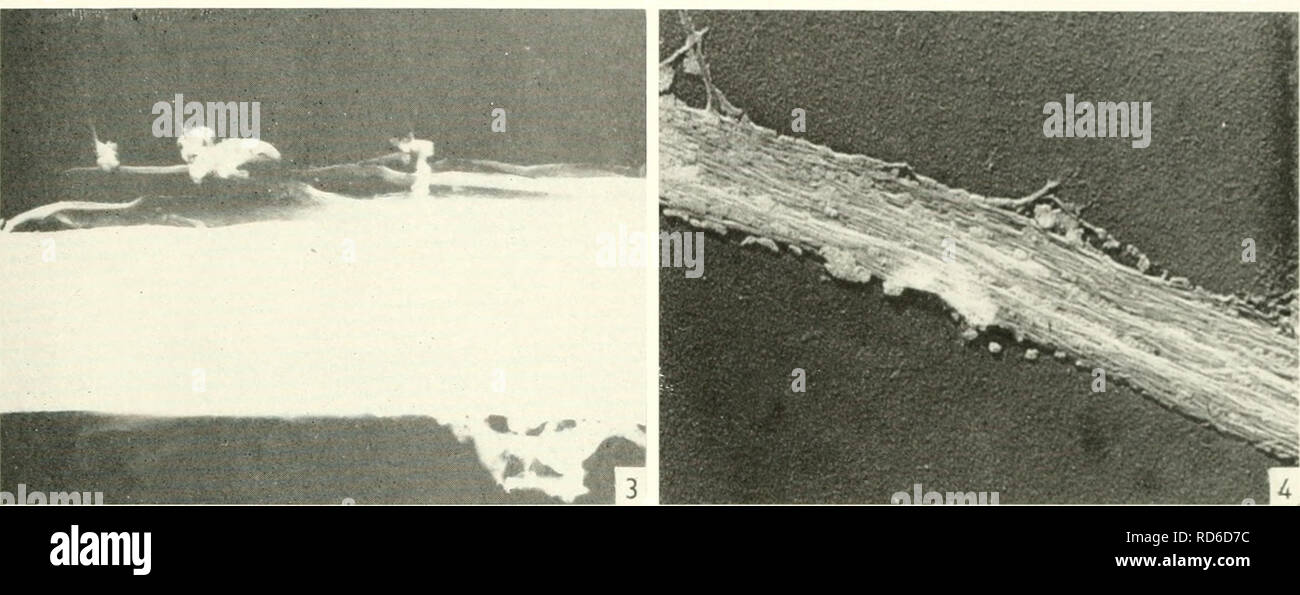 Electron microscopy of wool hi-res stock photography and images - Alamy