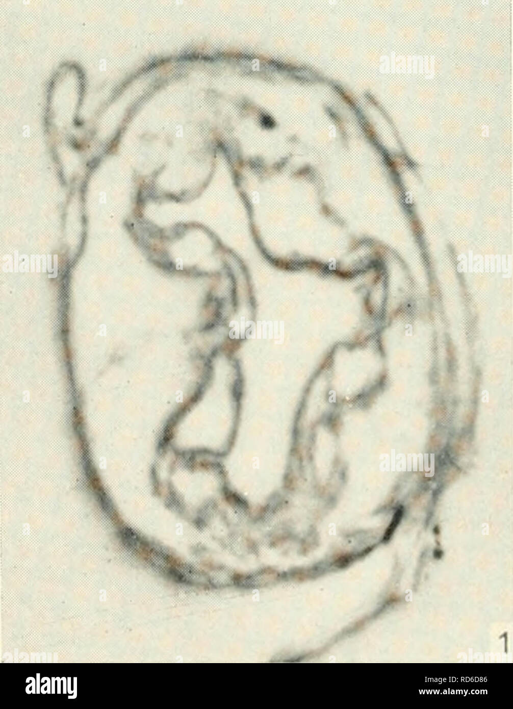 Cellulose fibers electron microscope hi-res stock photography and ...