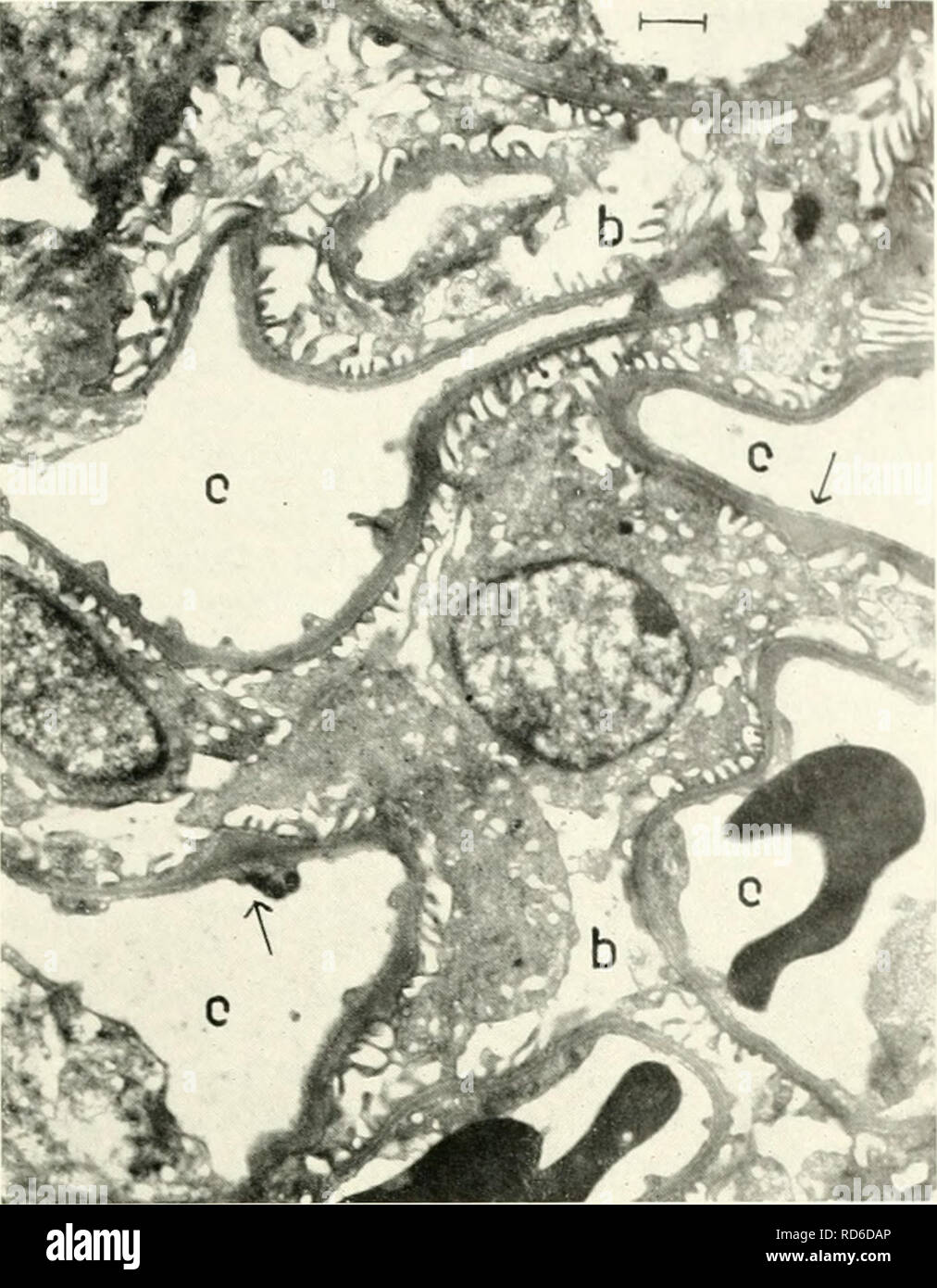 Glomerular Basement Membrane Em