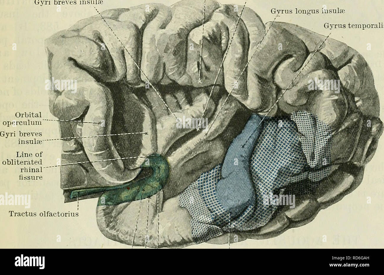 . Cunningham's Text-book of anatomy. Anatomy. THE SULCI AND GYEI OF THE ...