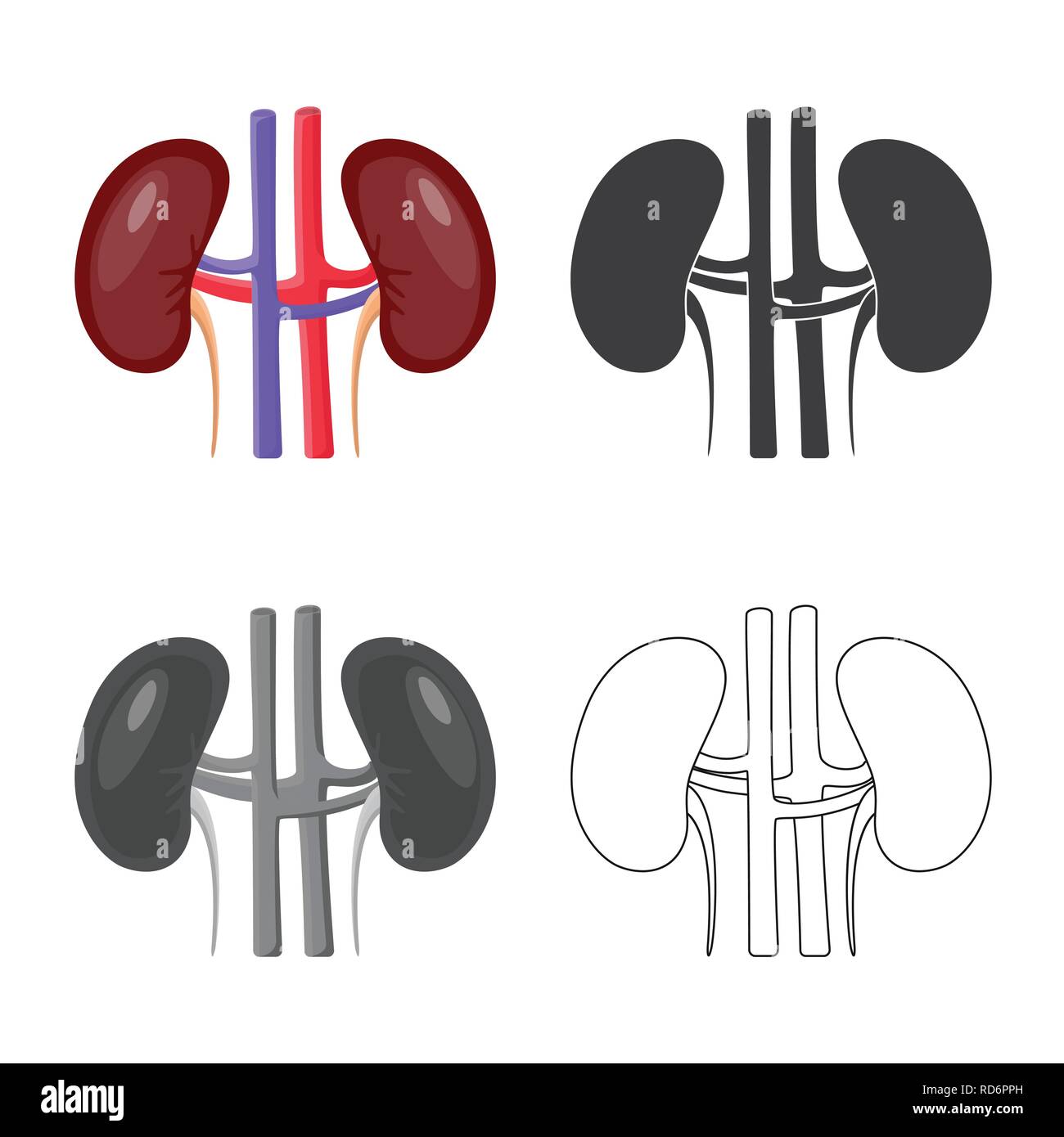 kidney,urinary,beans,transplant,stones,diagram,disease,donation,biology ...
