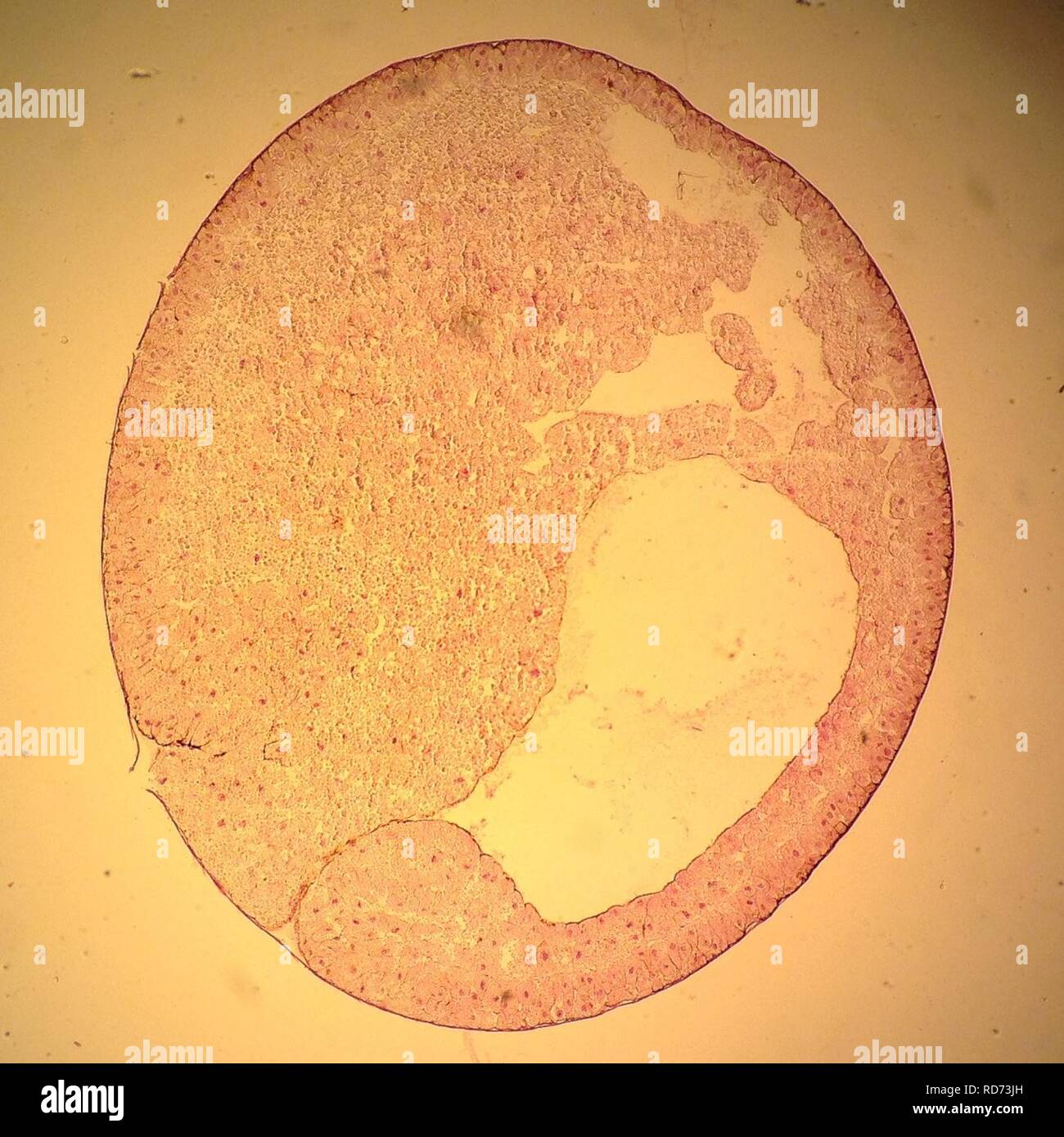 Gastrula hi-res stock photography and images - Alamy