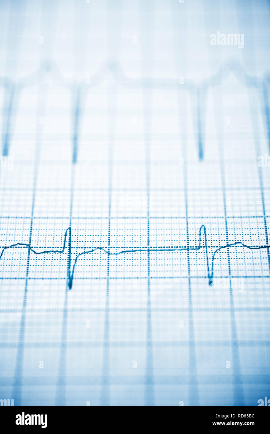 Close up of an electrocardiogram in paper form Stock Photo - Alamy