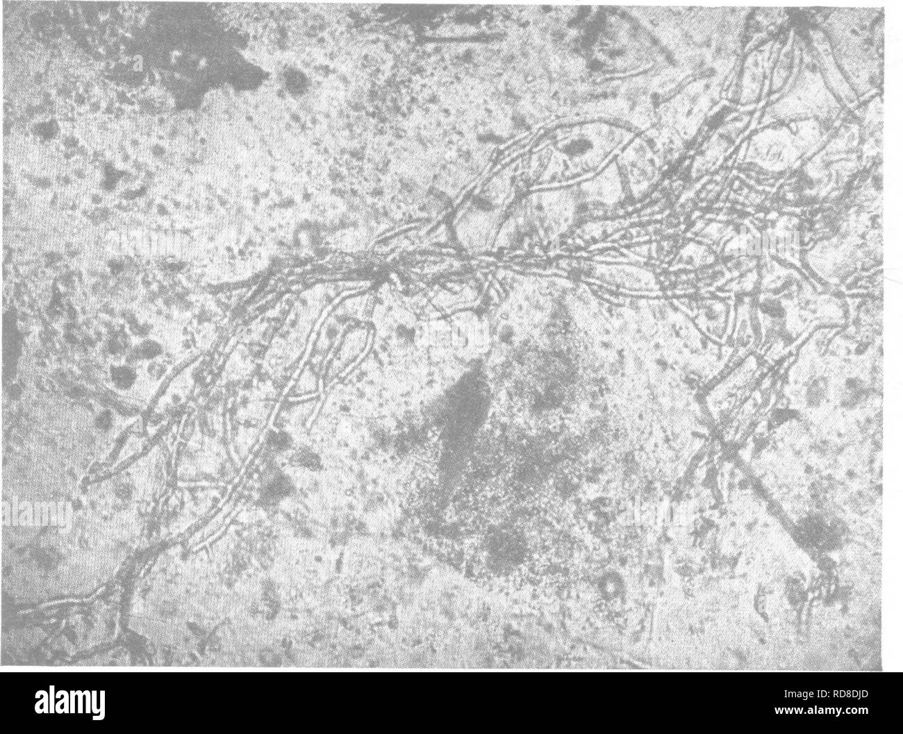 Mold cells Black and White Stock Photos & Images - Alamy