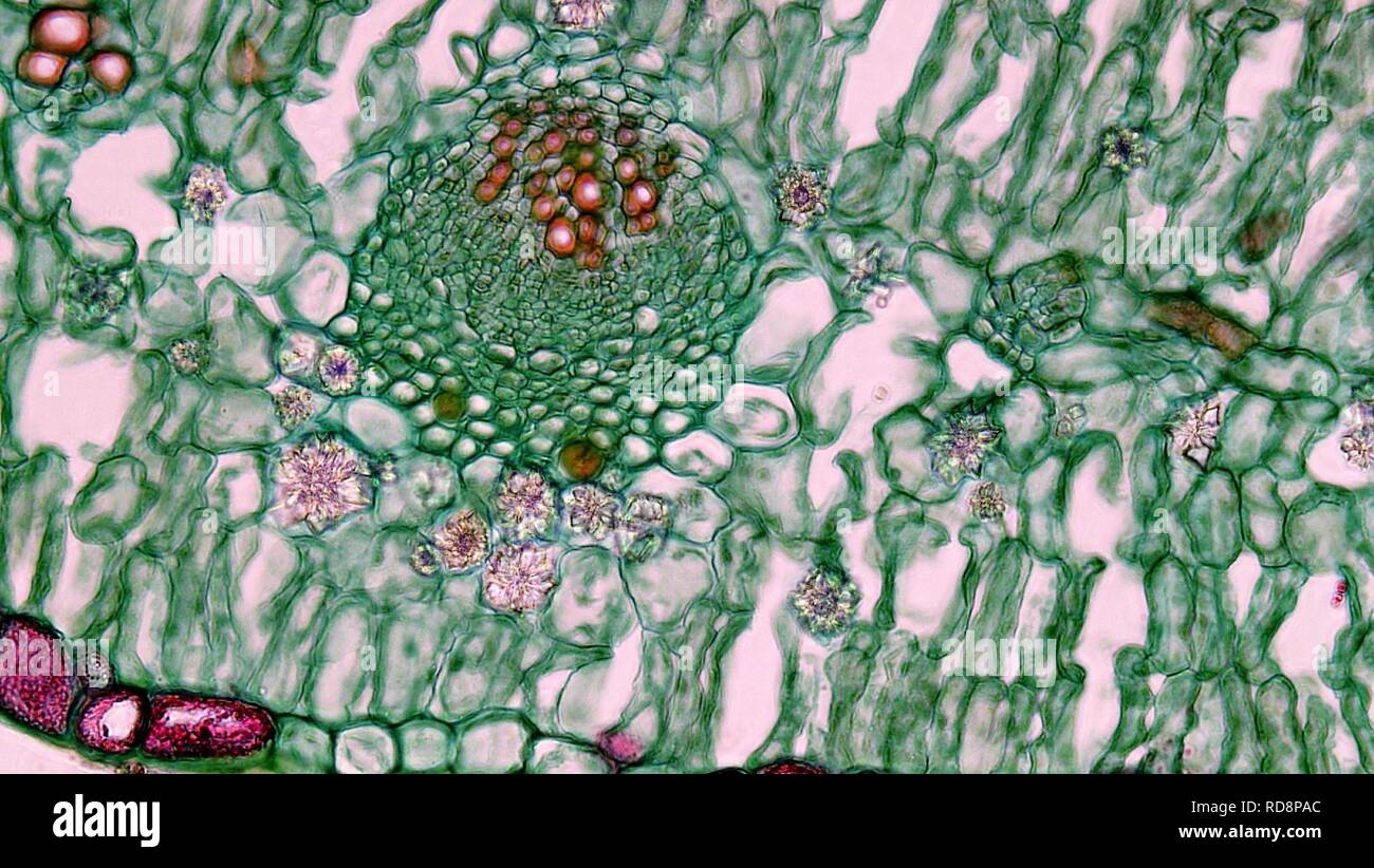 Angiosperm Morphology Bicollateral Vascular Bundle in the Leaf of ...