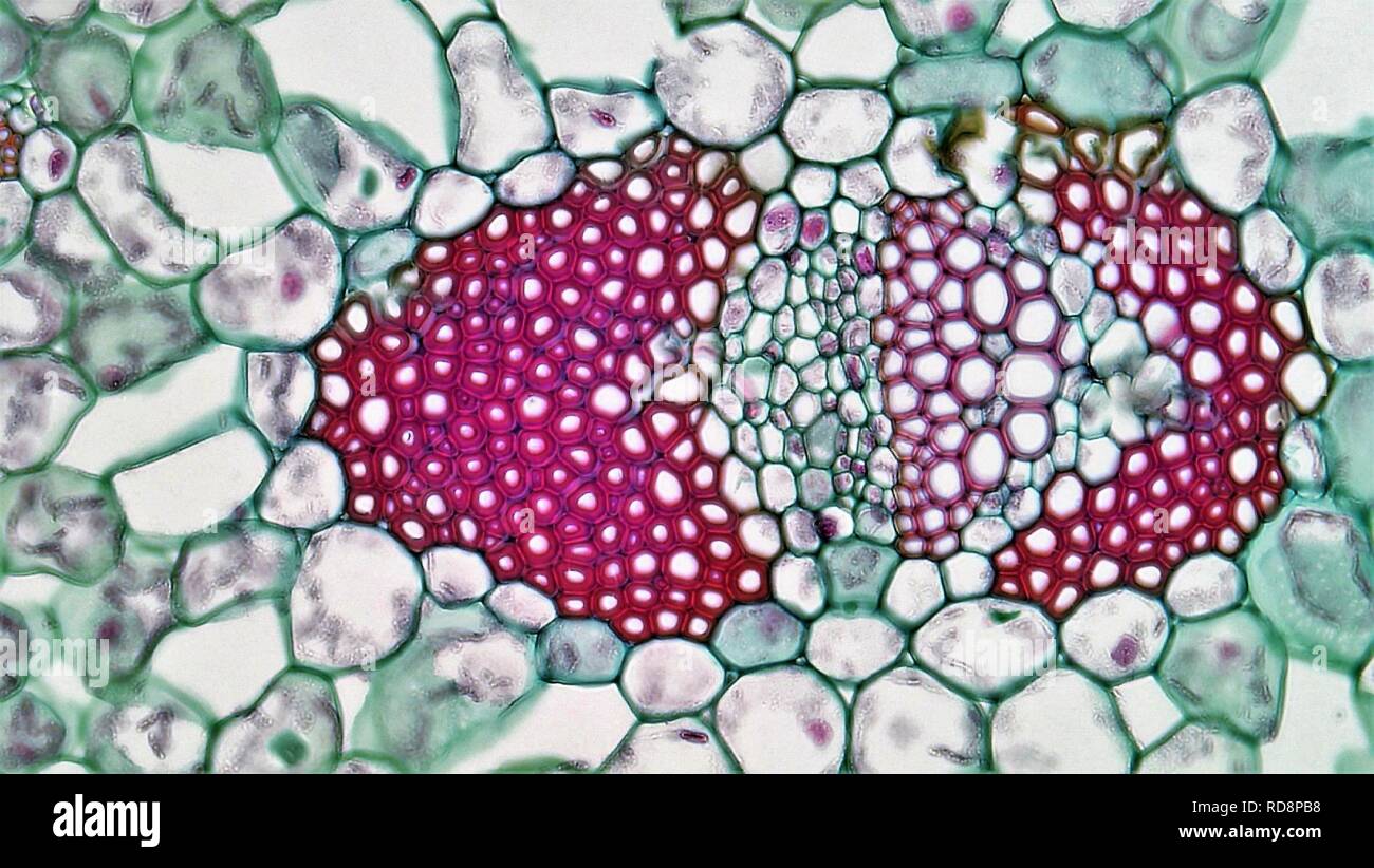 Angiosperm Morphology Central Vascular Bundle in Yucca Leaf ...