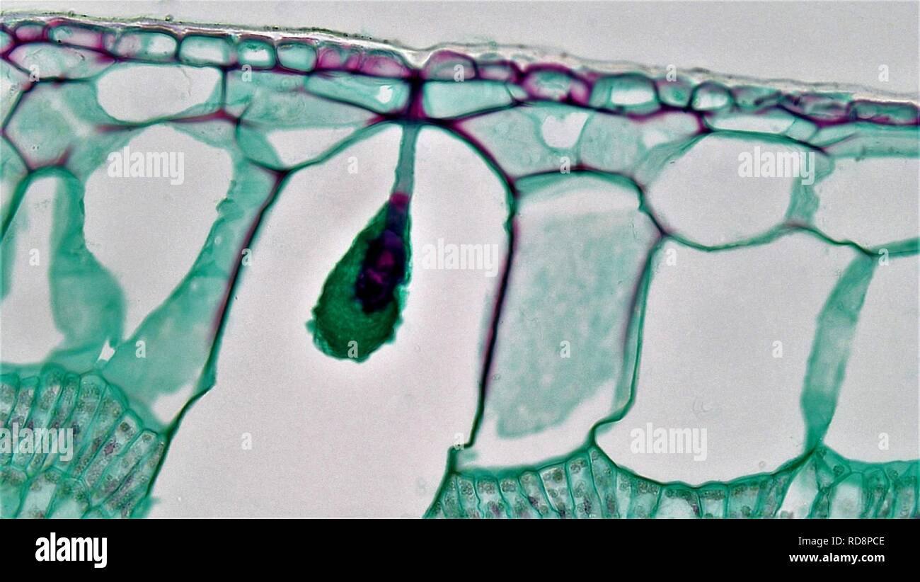 Angiosperm Morphology Lithocyst in Upper Epidermis in Ficus Leaf ...