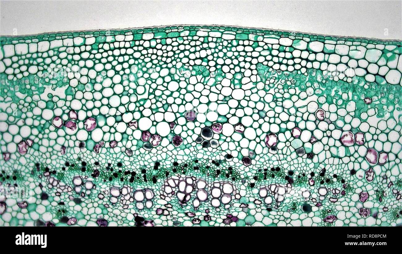 Angiosperm Morphology Lower Epidermis in Ficus Leaf (36376635982 Stock ...