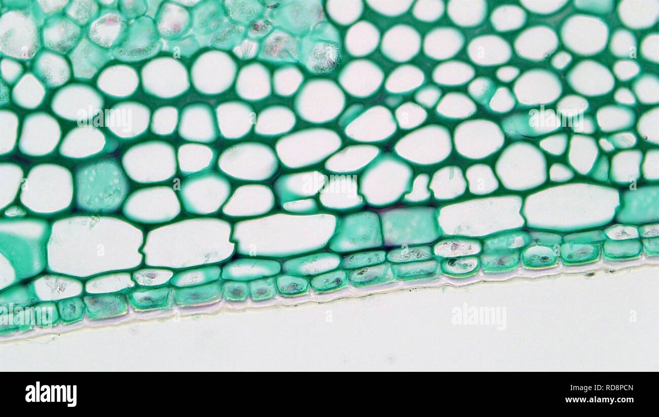 Angiosperm Morphology Lower Epidermis in Ficus Leaf (36529923876 Stock ...
