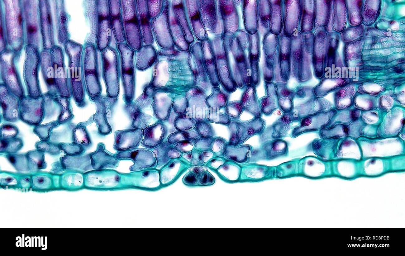 Angiosperm Morphology Peltate Trichome in Syringa Epidermis ...