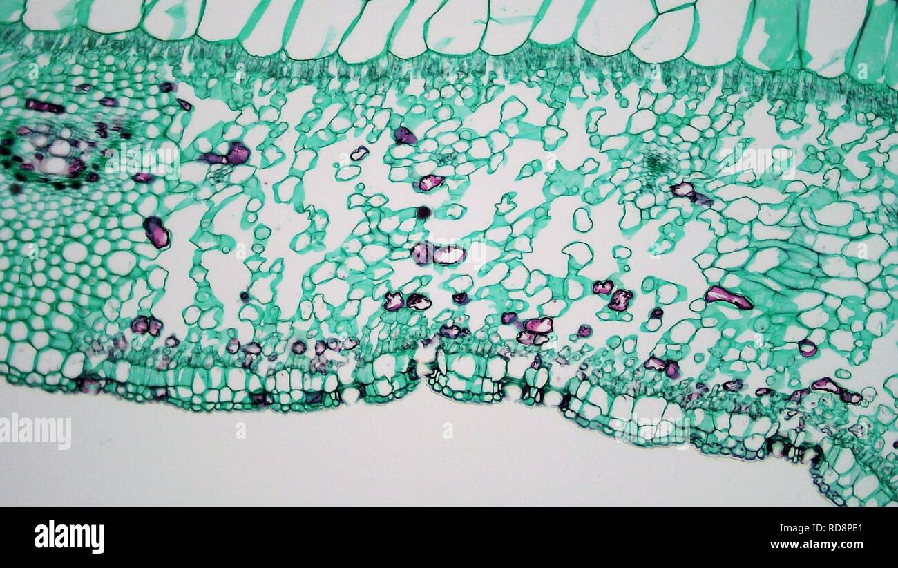 Angiosperm Morphology Stomatal Pits in Lower Epidermis of Ficus Leaf ...