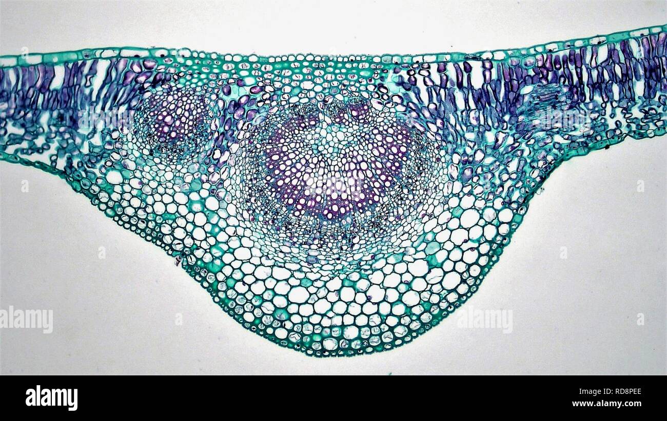 Angiosperm Morphology The Mesophytic Dicotyledonous Leaf of Syringa ...