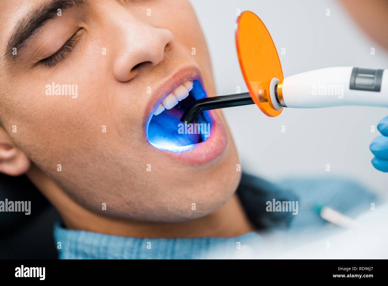 Whitening procedure hi-res stock photography and images - Alamy