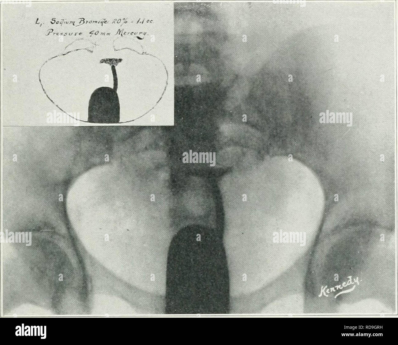 "American journal of obstetrics and gynecology" (1920 Stock Photo - Alamy