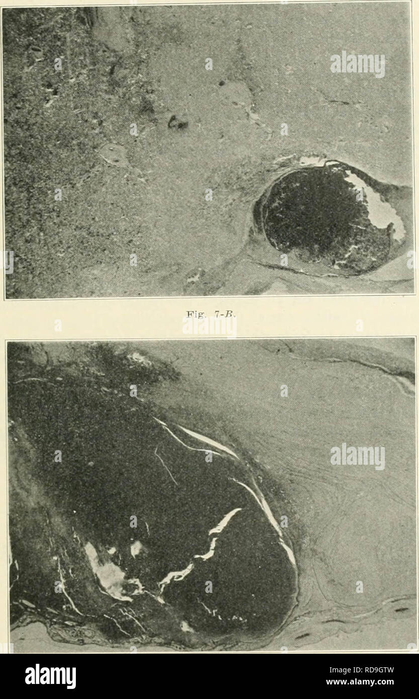 "American journal of obstetrics and gynecology" (1920 Stock Photo - Alamy