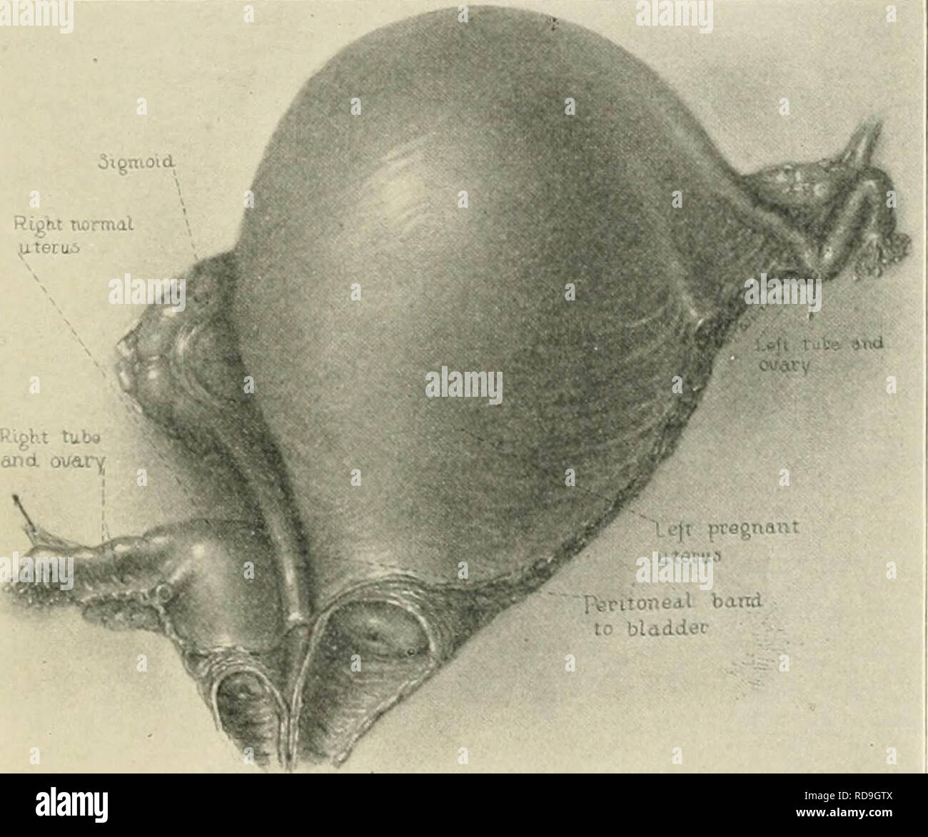 "American journal of obstetrics and gynecology" (1920 Stock Photo - Alamy