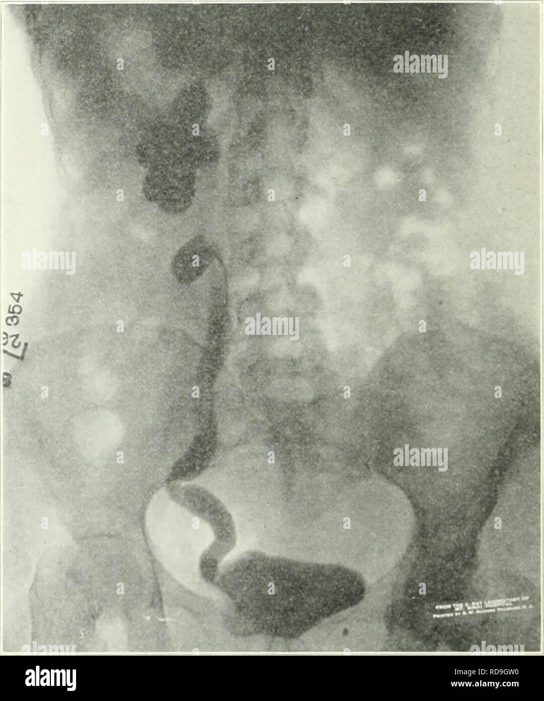 "American journal of obstetrics and gynecology" (1920 Stock Photo - Alamy