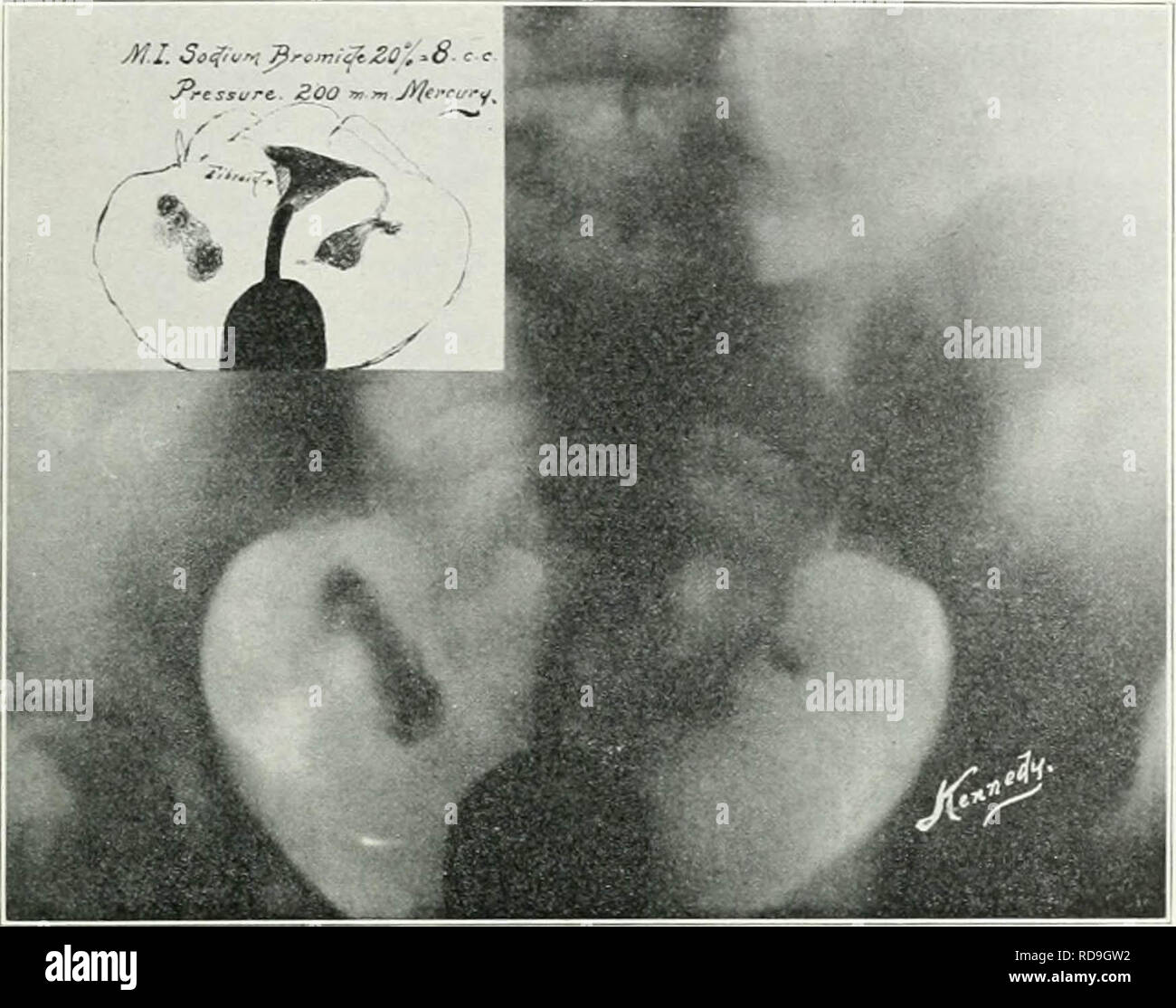 "American journal of obstetrics and gynecology" (1920 Stock Photo - Alamy