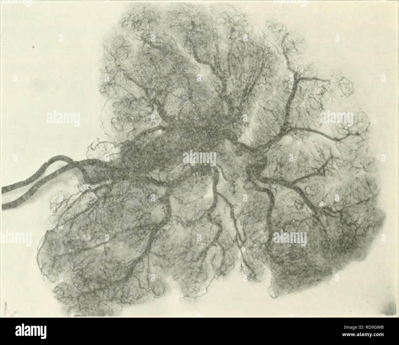 "American journal of obstetrics and gynecology" (1920 Stock Photo - Alamy