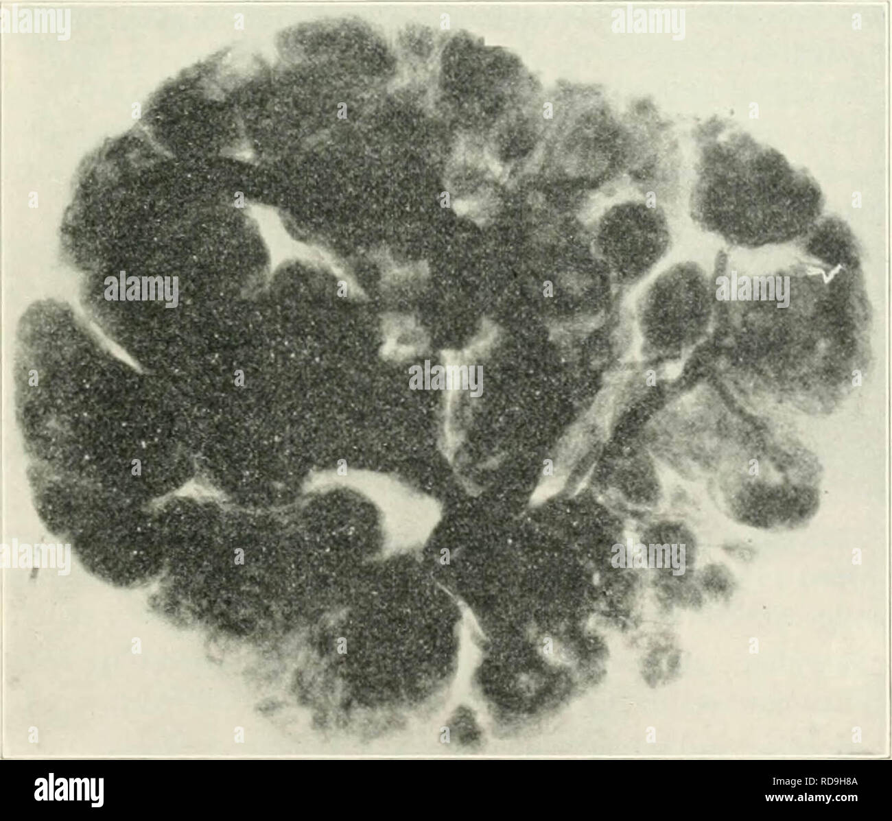 "American journal of obstetrics and gynecology" (1920 Stock Photo - Alamy