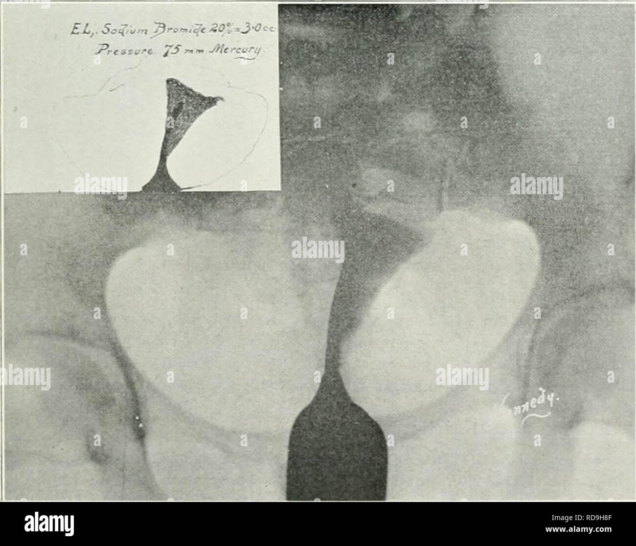 "American journal of obstetrics and gynecology" (1920 Stock Photo - Alamy