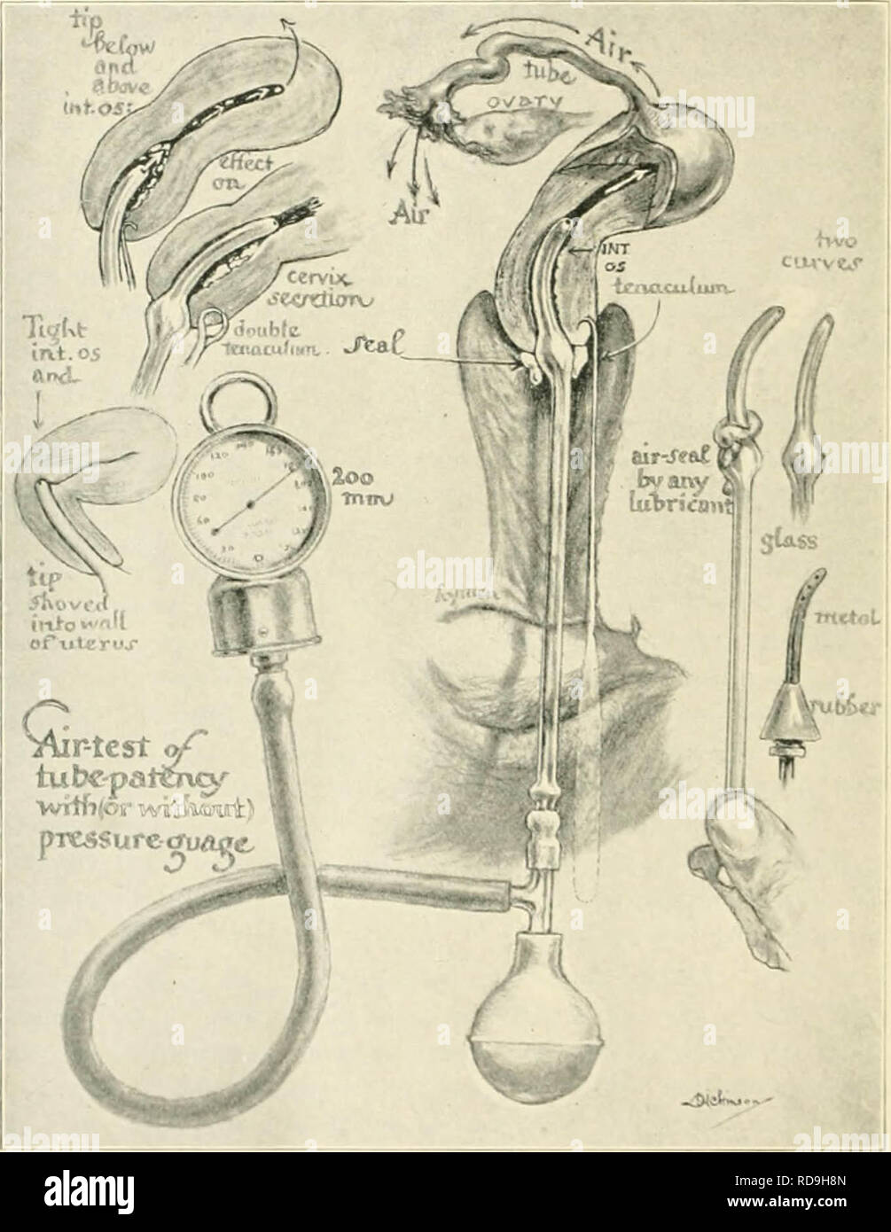 "American journal of obstetrics and gynecology" (1920 Stock Photo - Alamy
