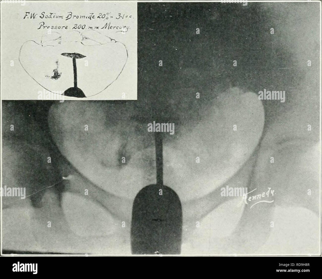 "American journal of obstetrics and gynecology" (1920 Stock Photo - Alamy