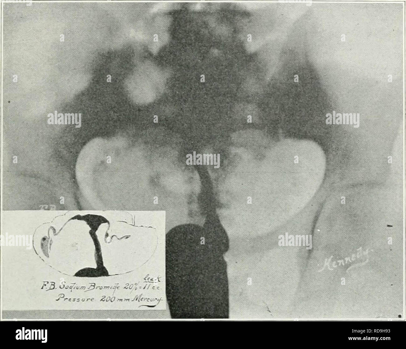 "American journal of obstetrics and gynecology" (1920 Stock Photo - Alamy