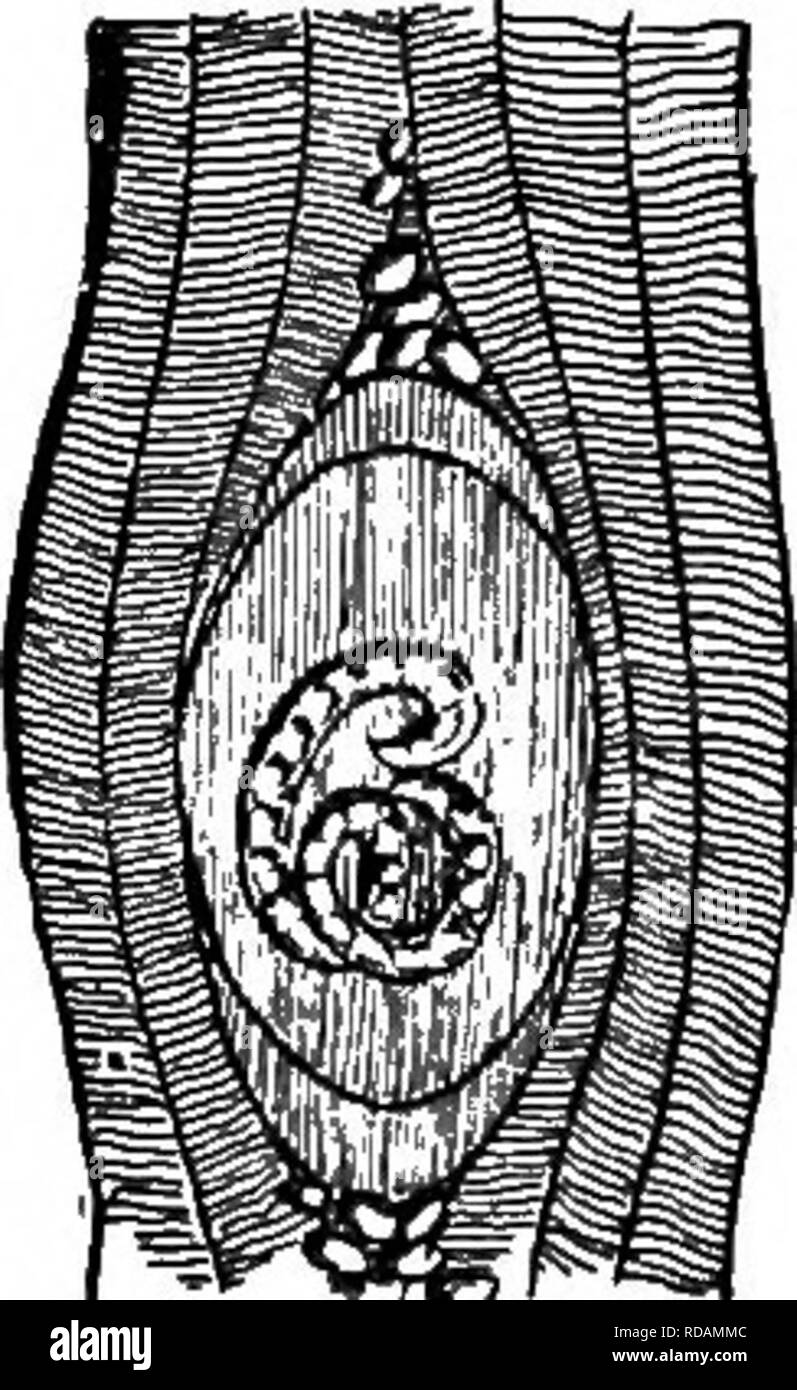 Trichinella Spiralis Encysted Larvae Labelled