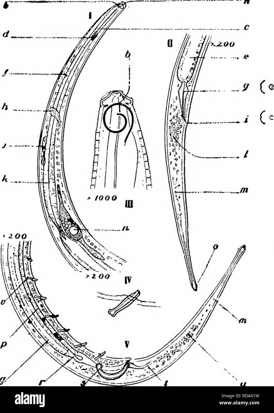 Uterus lateral view Black and White Stock Photos & Images - Alamy