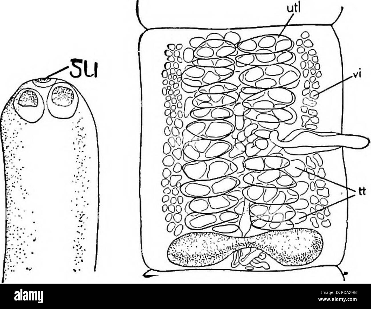 Tapeworm Proglottids Labeled