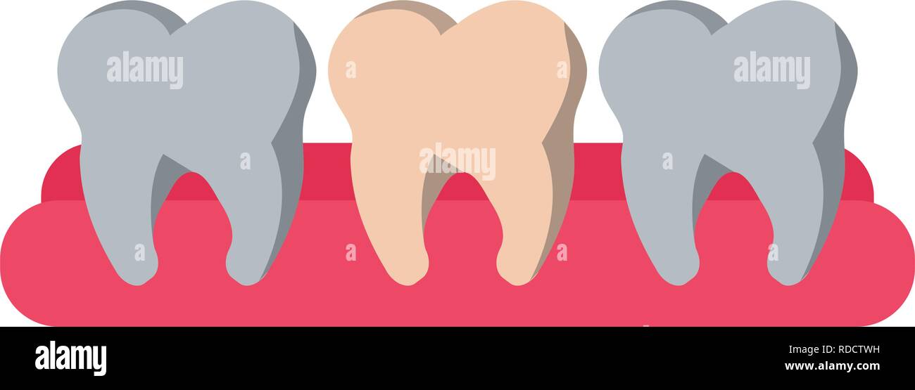 Teeth in gum cartoon Stock Vector Image & Art - Alamy