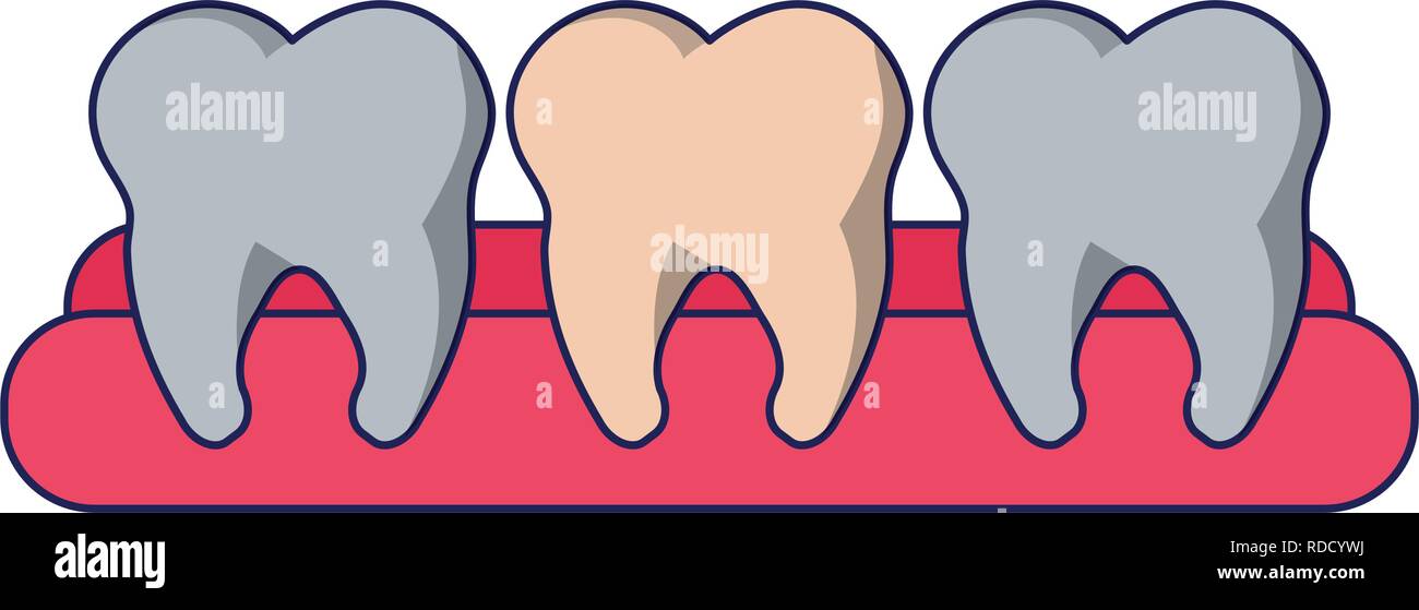 Teeth in gum cartoon Stock Vector Image & Art - Alamy