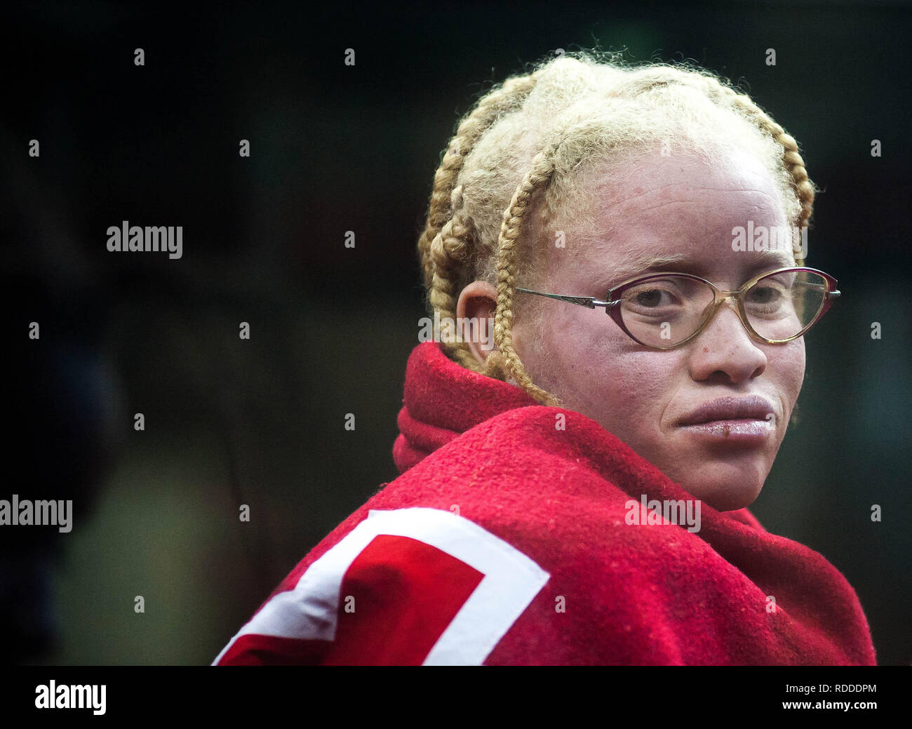 Hispanic Albino
