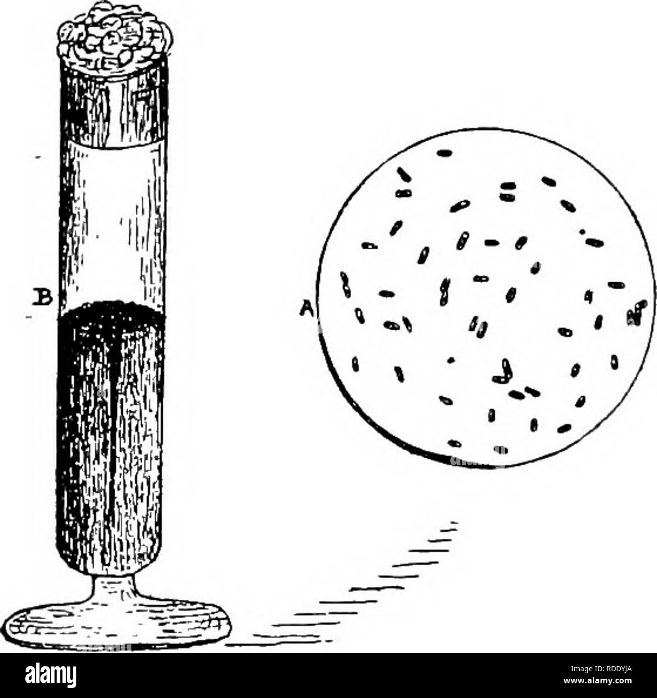 Chromogenic agar hi-res stock photography and images - Alamy