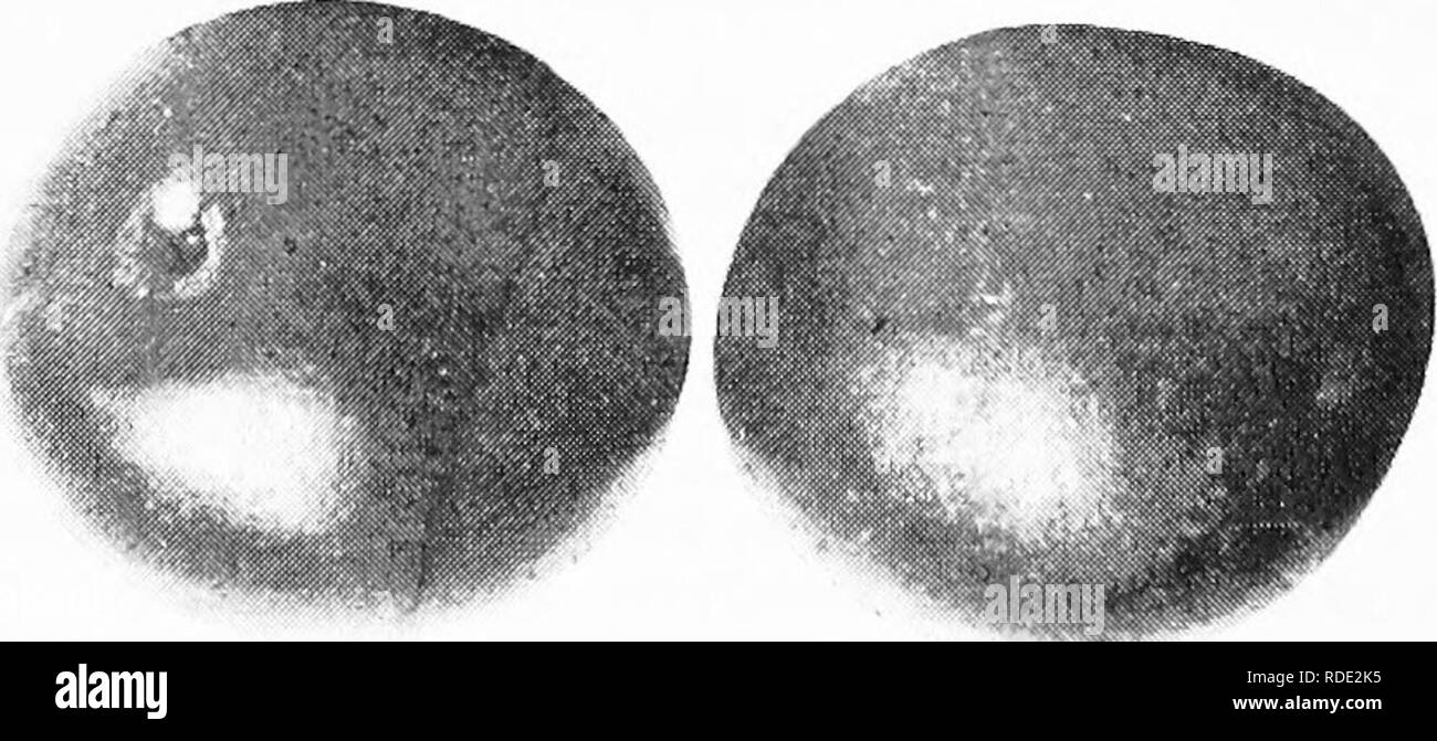 Red dots skin Black and White Stock Photos & Images - Alamy