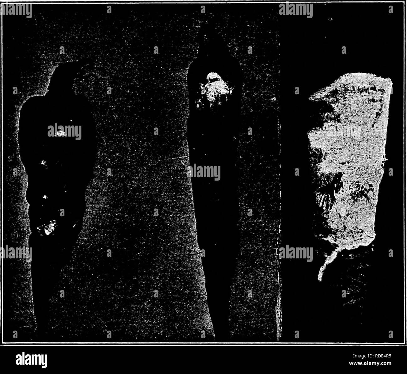 Arachnoid layer hi-res stock photography and images - Alamy