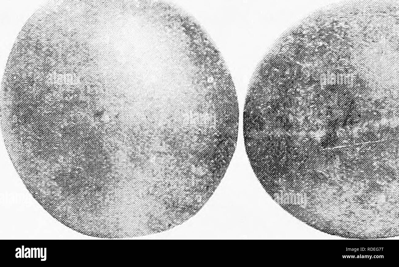 Red dots skin Black and White Stock Photos & Images - Alamy